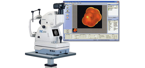 Digital fluoroangiography with TOPCON RETINAL CAMERA (IMAGEnet inc ...